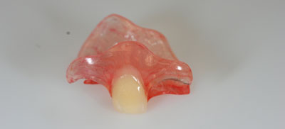 Prothetik:Flexibel | Dental Studio Feindler GmbH