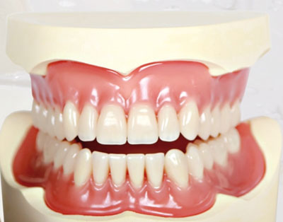 Prothese:Totalprothese | Dental Studio Feindler GmbH